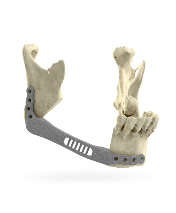 Maxillofacial - MT ORTHO