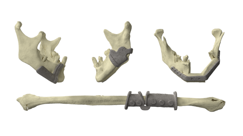 Maxillofacial - MT ORTHO